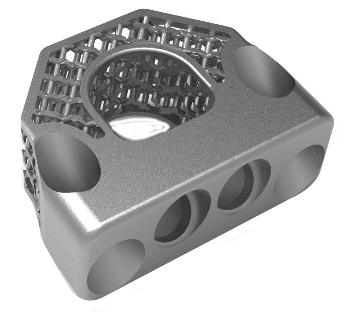 Interbody Fusion Cage-3D printed Cage Systems-Trauhui