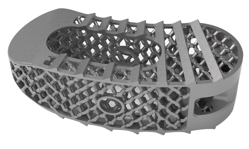 Interbody Fusion Cage-3D printed Cage Systems-Trauhui